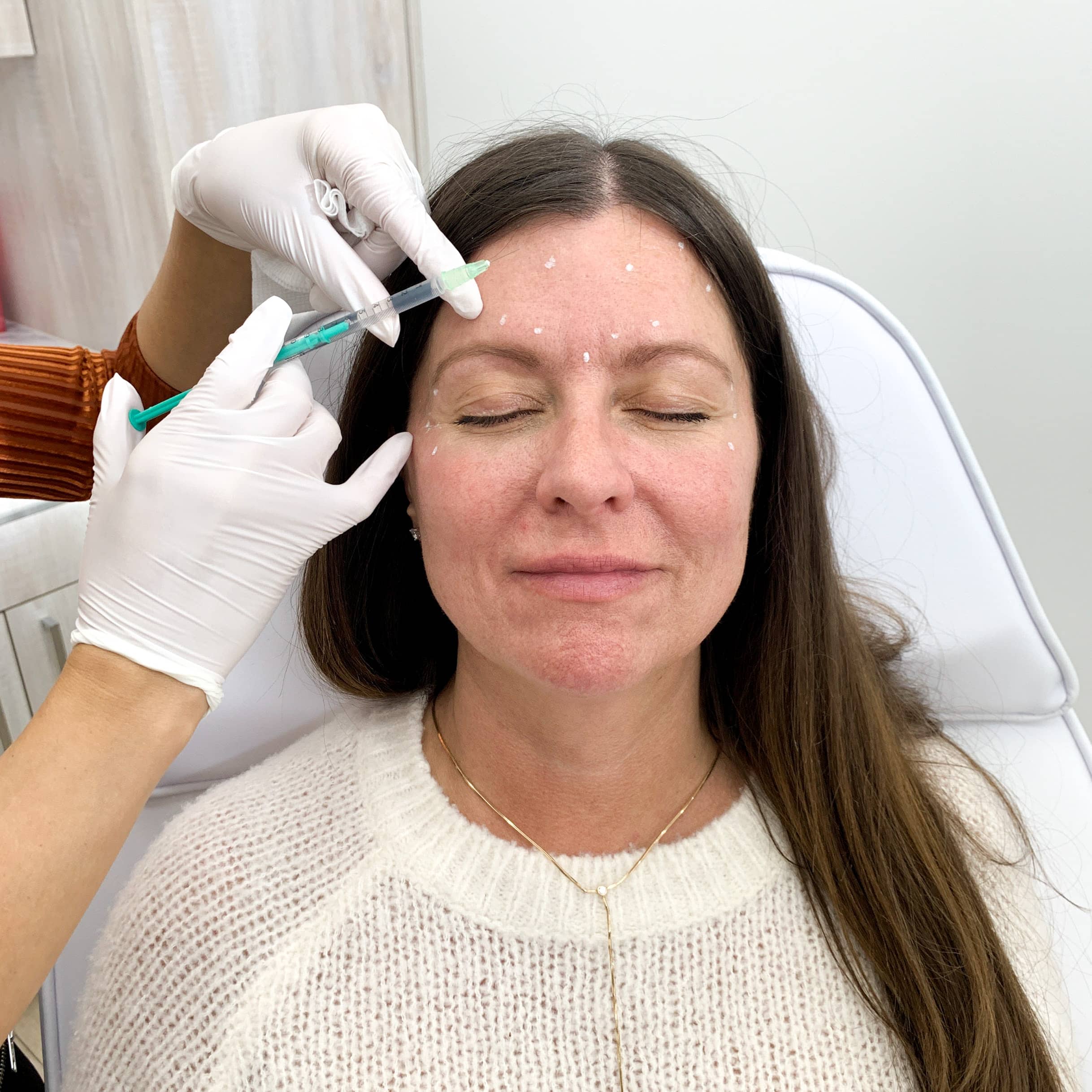 Why Botox Alone Is Not Enough to Stop Wrinkles | SLK Clinic