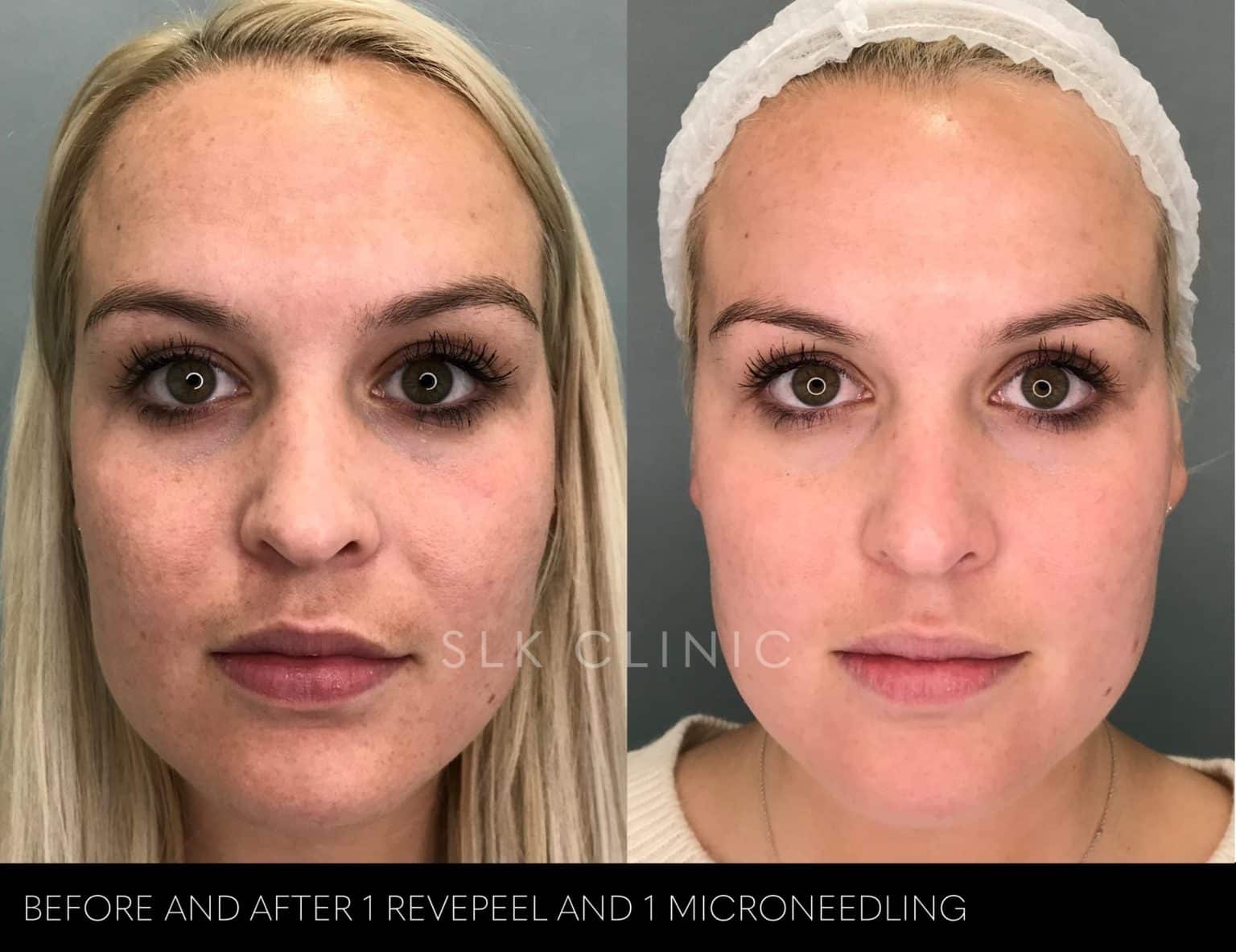 Enlighten Mask: Advanced Skin Brightening Treatment